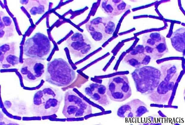 Bacterial Diseases | Top 14 Most Deadliest Diseases Caused By Bacteria