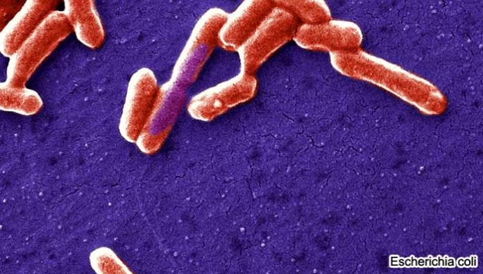 Bacterial Diseases | Top 14 Most Deadliest Diseases Caused By Bacteria