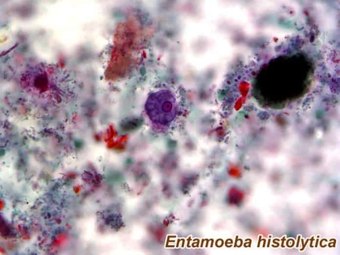 Top 12 Diseases Caused By Protozoa | Malaria, Trypanosomiasis & More