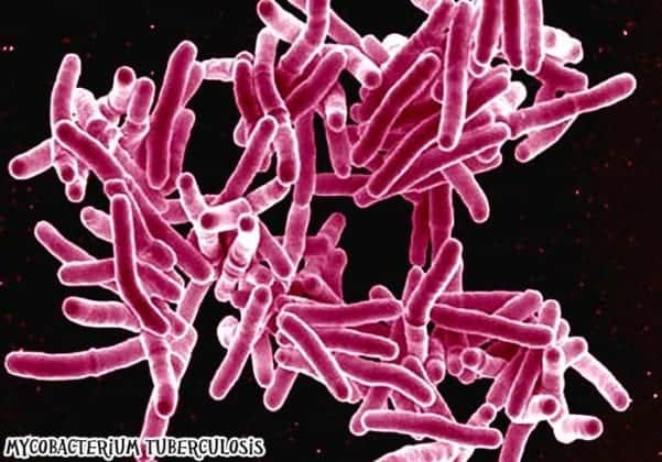 Bacterial Diseases | Top 14 Most Deadliest Diseases Caused By Bacteria