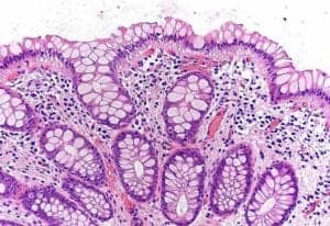 Goblet Cells | Definition, Functions, Mucus Secretion and Diseases