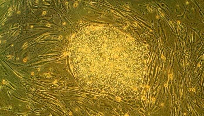 Top 17 Stem Cell Research Pros and Cons | BioExplorer.Net
