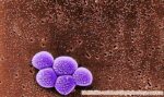 Bacterial Diseases | Top 14 Most Deadliest Diseases Caused By Bacteria