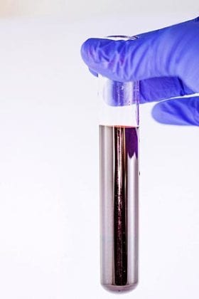 12 Pros and Cons of Genetic Testing | Biology Explorer