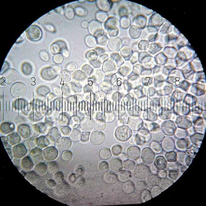 Microbiology | Medical Microbiology | Study of Microbes | BioExplorer.Net